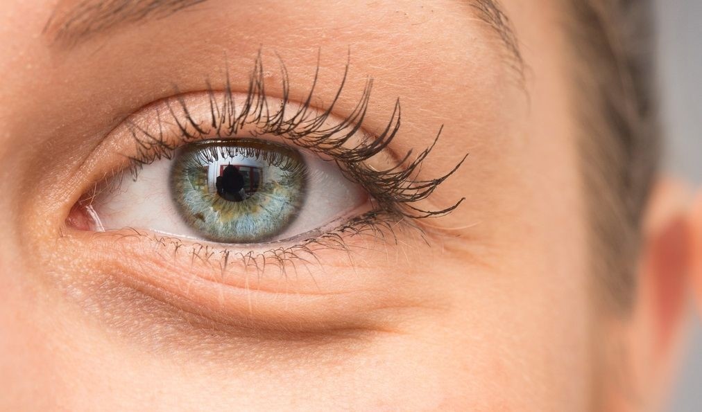 Wirksam Augenringe entfernen - Blepharoplastik, Laser oder ...